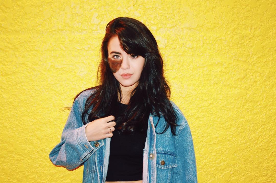 Woman Proudly Accepted Her Facial Birthmark After Rude Agent Told Her