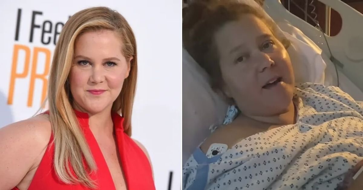 Amy Schumer Reveals She Had Her Uterus Removed While Battling Her