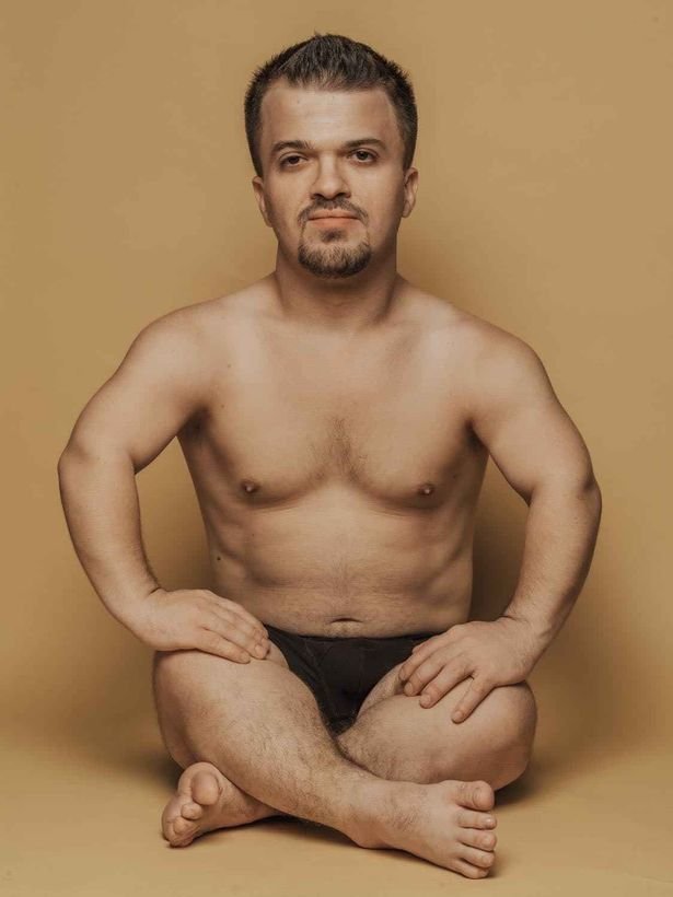 Man Dubbed King Dwarf Says Peoples Reactions To His Manhood Inside